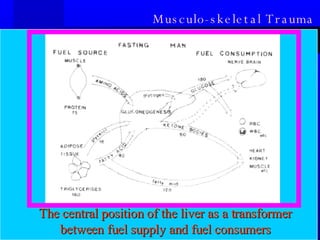 Multiple Trauma 3 | PPT