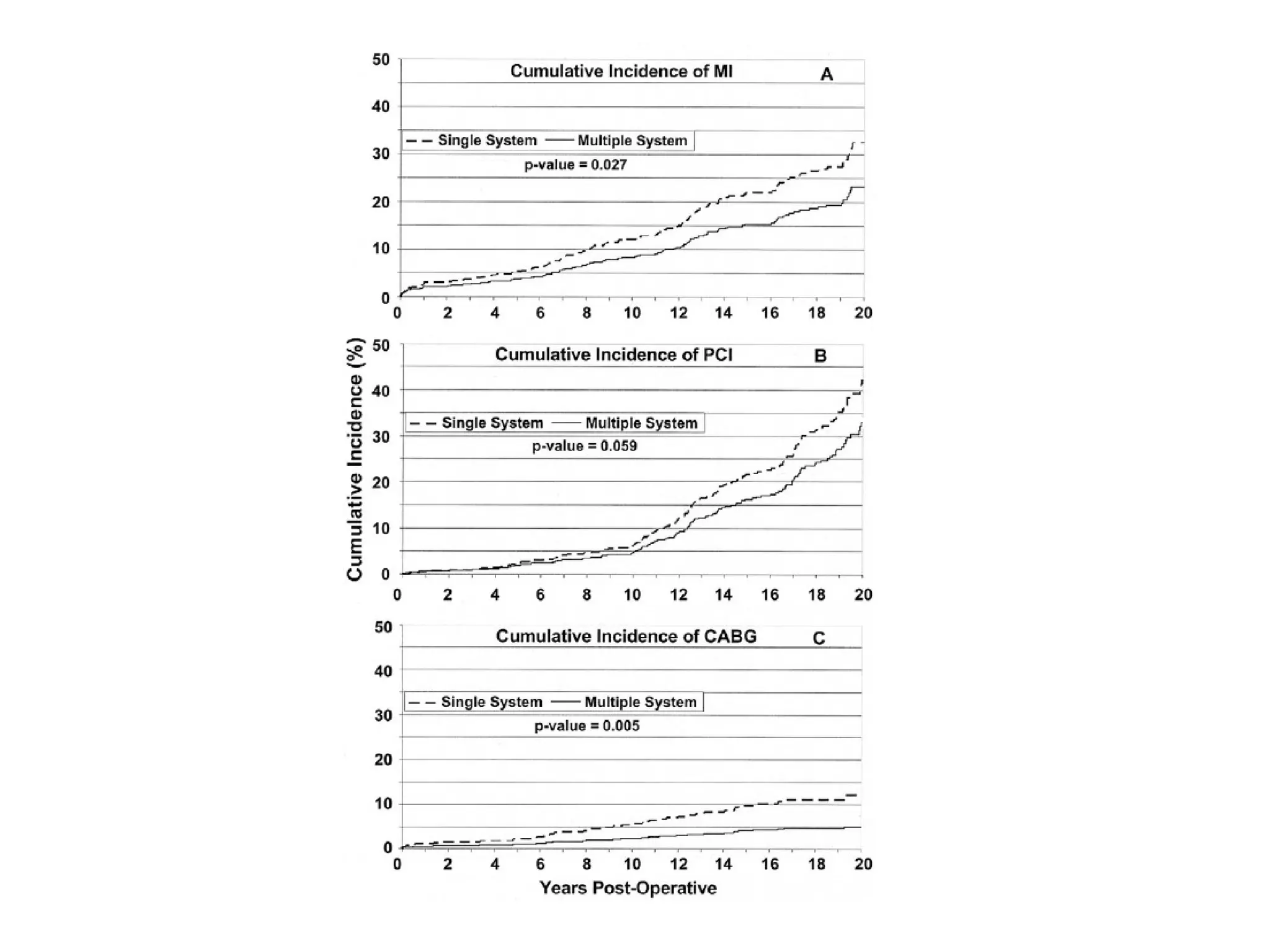 Multiple Arterial Graft Cabg Ppt