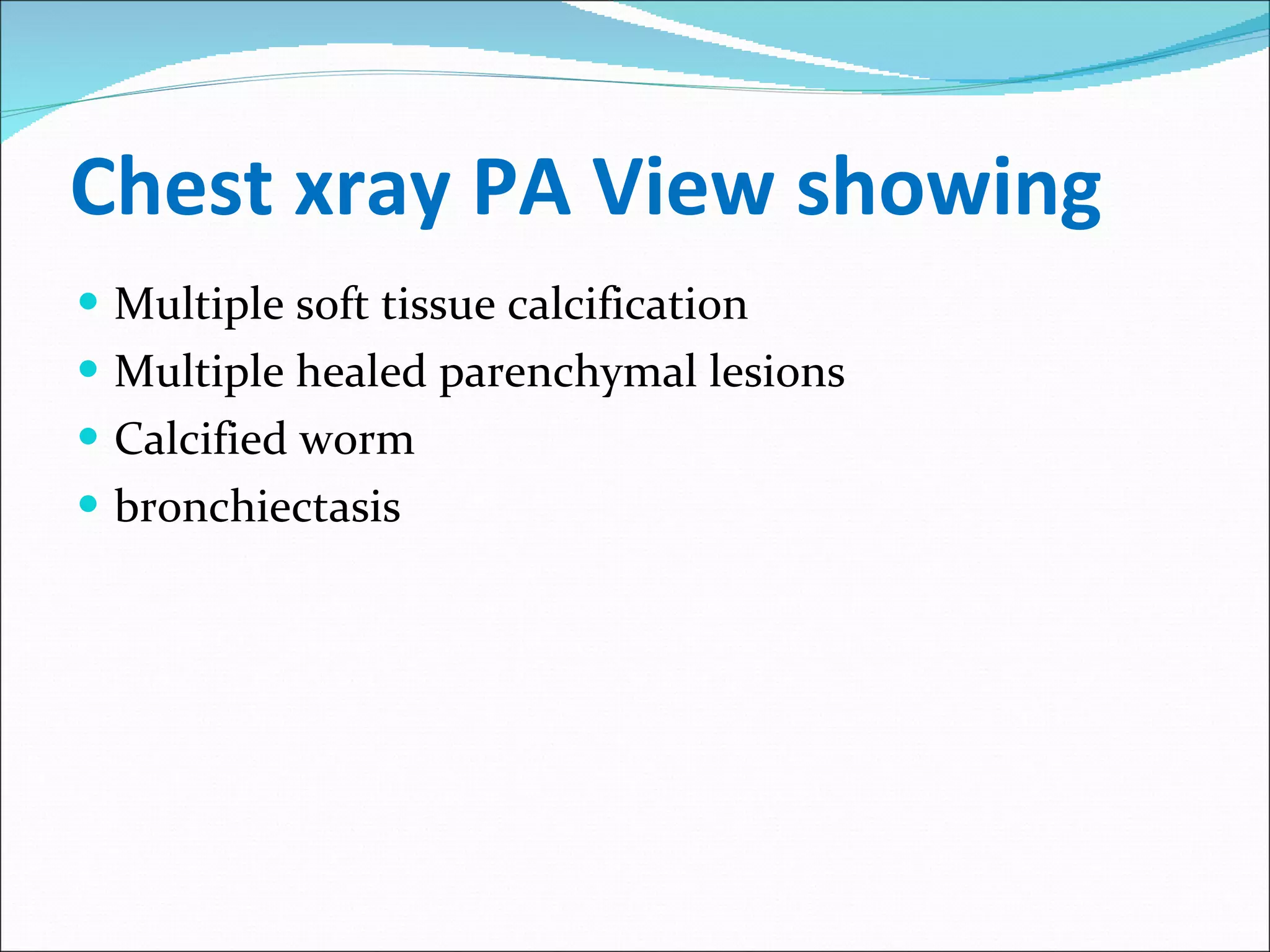 CXR: Multiple calcifications | PPT | Diseases and Conditions | Medical ...
