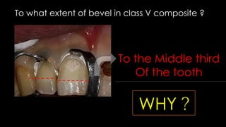 Multiple class v case presentation | PPT