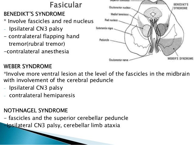 Multiple cranial nerve palsy final