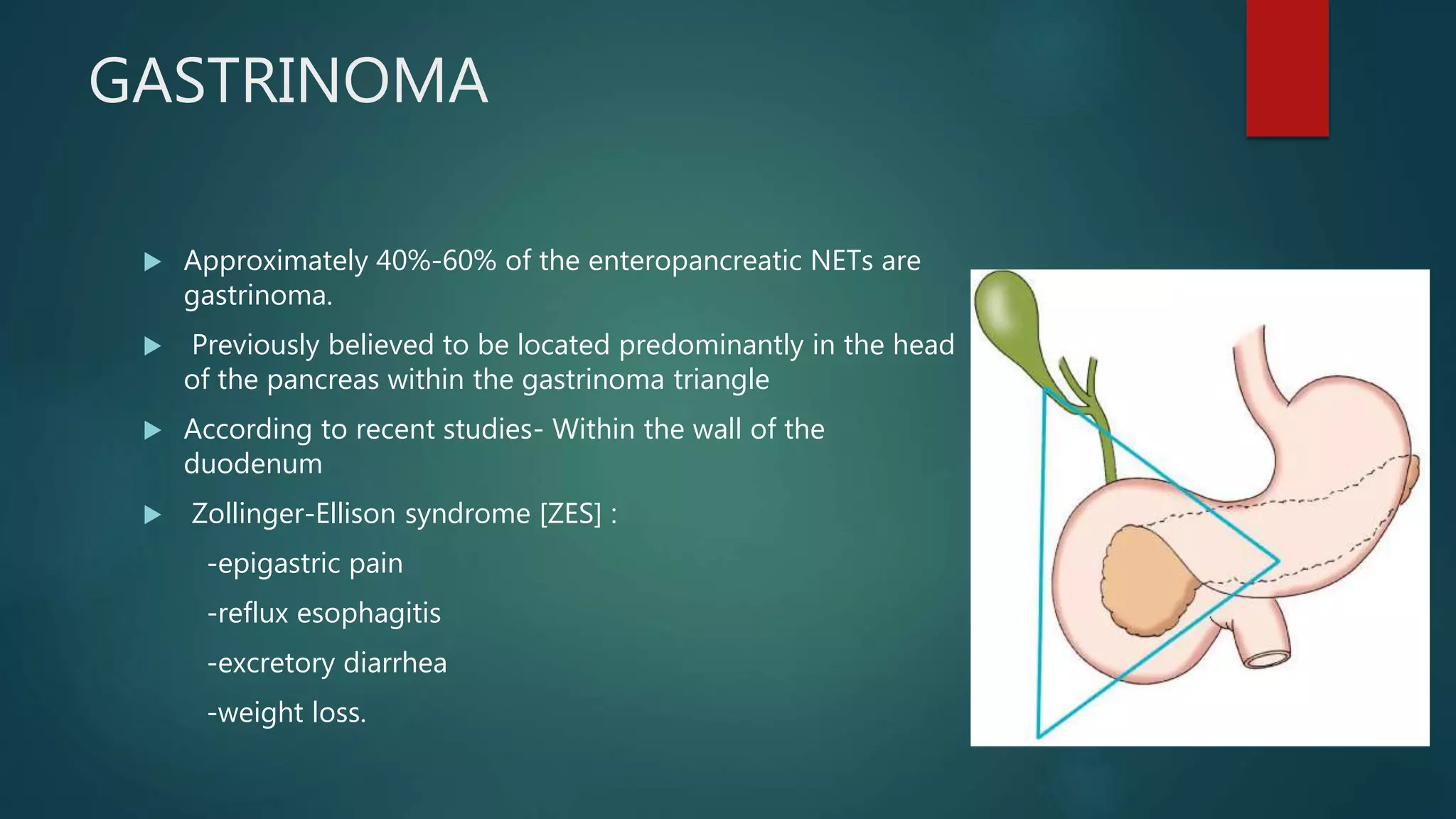 Multiple endocrine neoplasia and neuroendocrine tumour of pancrease | PPTX