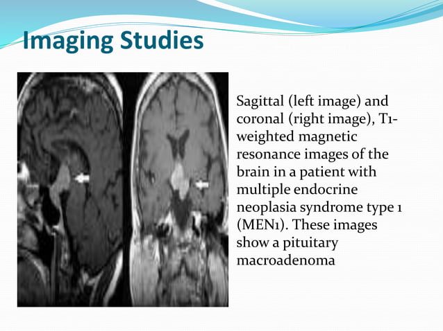 Multiple endocrine neoplasia (men) syndromes | PPTX | Endocrine and ...