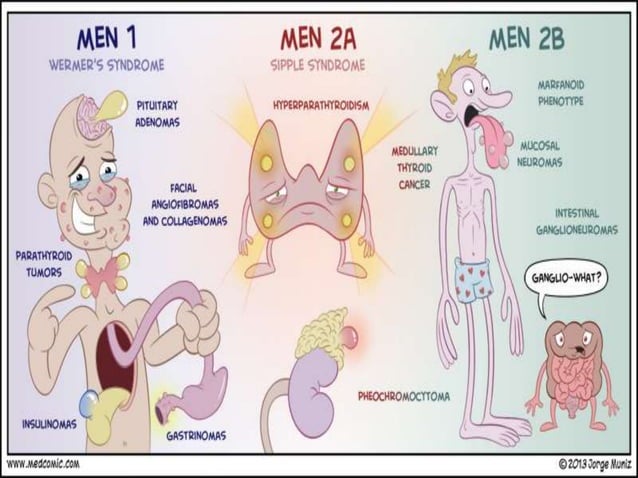 Multiple endocrine neoplasia (men) syndromes | PPTX | Endocrine and ...