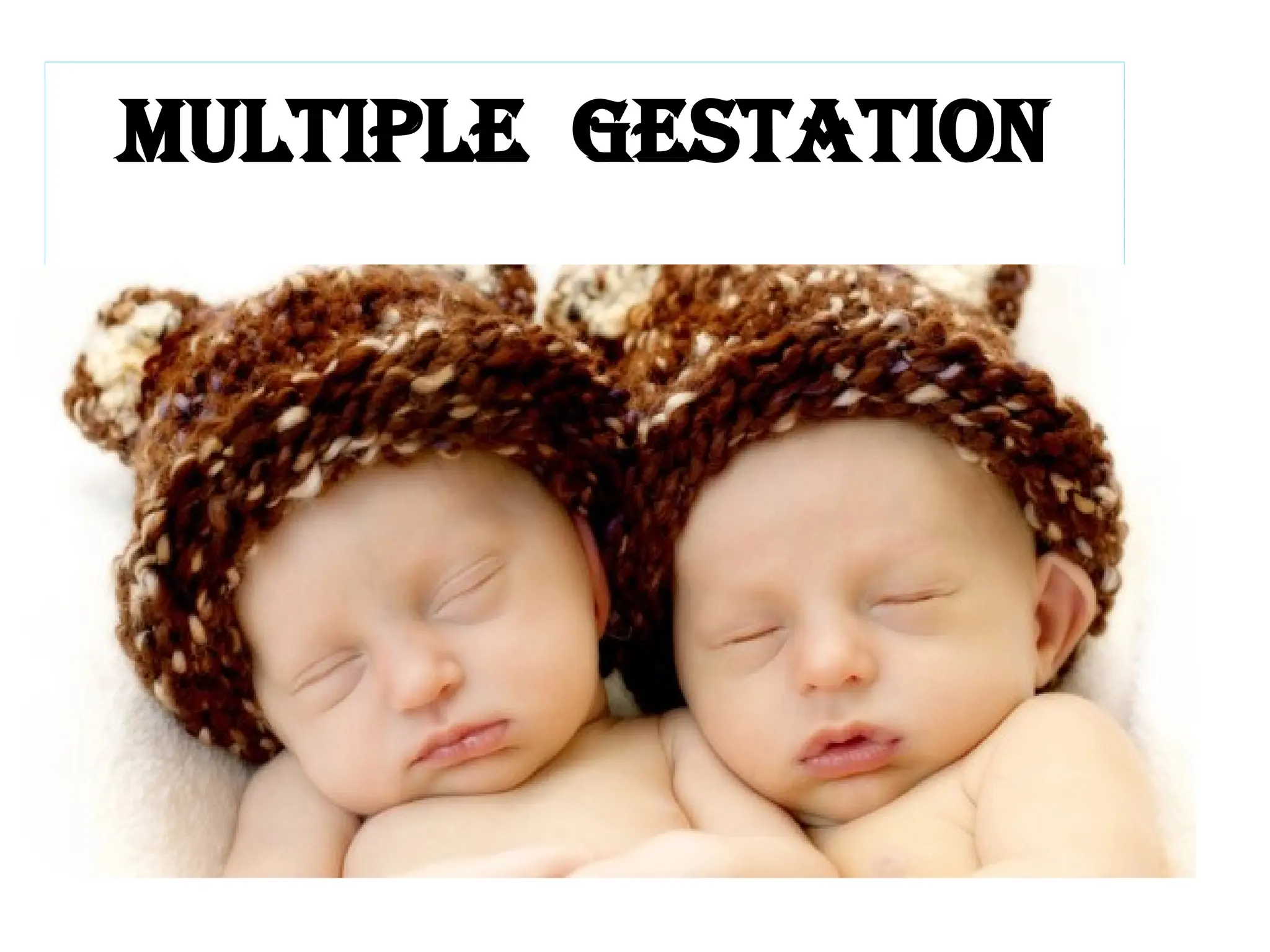 MULTIPLE_GESTATION.pptxyyyryhegyfryhgtgu | PPT