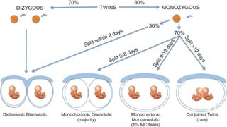 Multiple gestation [autosaved].pptx 1 | PPT