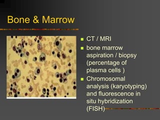 Multiple Myeloma | PPT