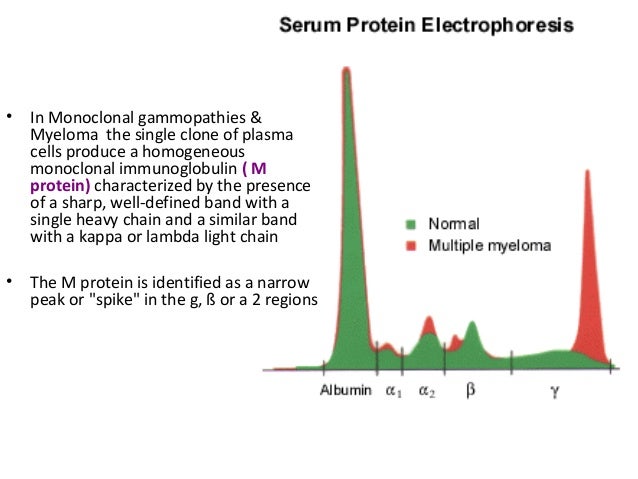 Lambda Light Chain Multiple Myeloma | Americanwarmoms.org