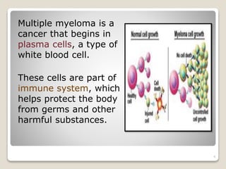 (Multiple Myeloma) MM | PPTX