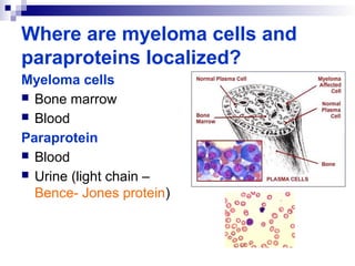 Multiple Myeloma | PPT