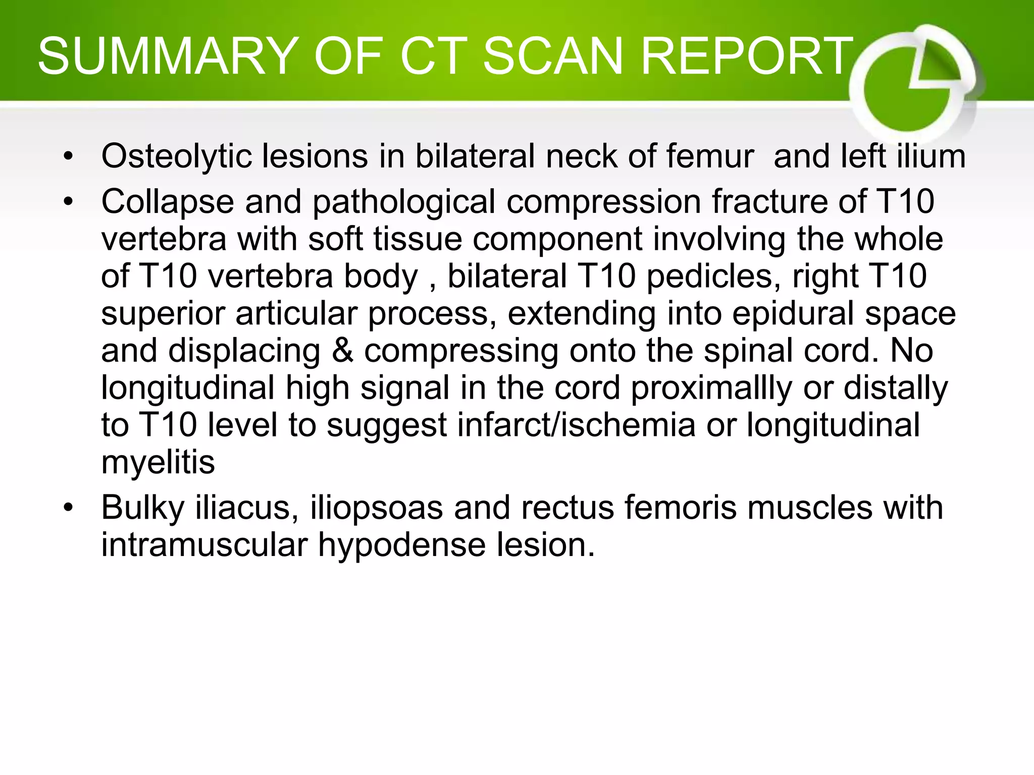 Multiple myeloma | PPTX