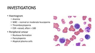 Multiple myeloma | PPTX