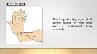 multiple myeloma important condition to note | PPTX