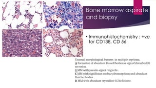 Multiple myeloma is hematological disorder affecting plasma cells ...