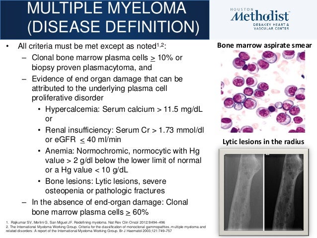 Multiple myeloma and al amyloidosis