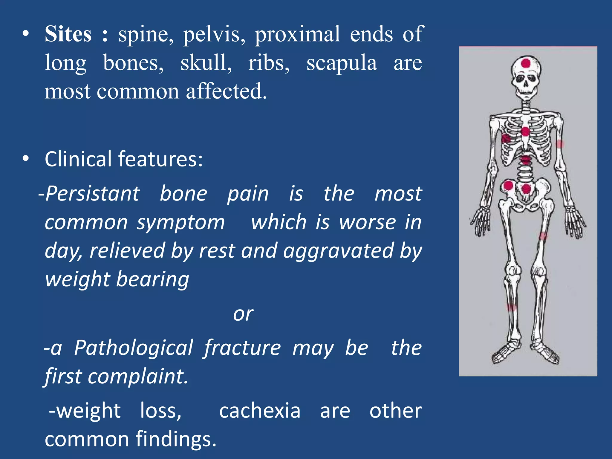 Case Presentation on Multiple Myeloma by Dr. Brajesh K. Ben | PPTX