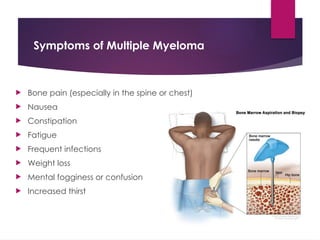 Multiple_Myeloma_Presentation Multiple_Myeloma_Presentation Multiple ...