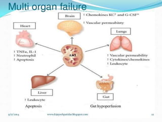 Multiple organ dysfunction syndrome | PPTX