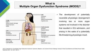 Multiple Organ Dysfunction Syndrome.pptx