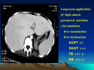 Multiple Organ Dysfunction Syndrome2009 | PPT