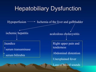 Multiple Organ Dysfunction Syndrome2009 | PPT