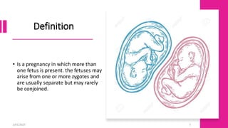 Multiple pregnancies.pptx