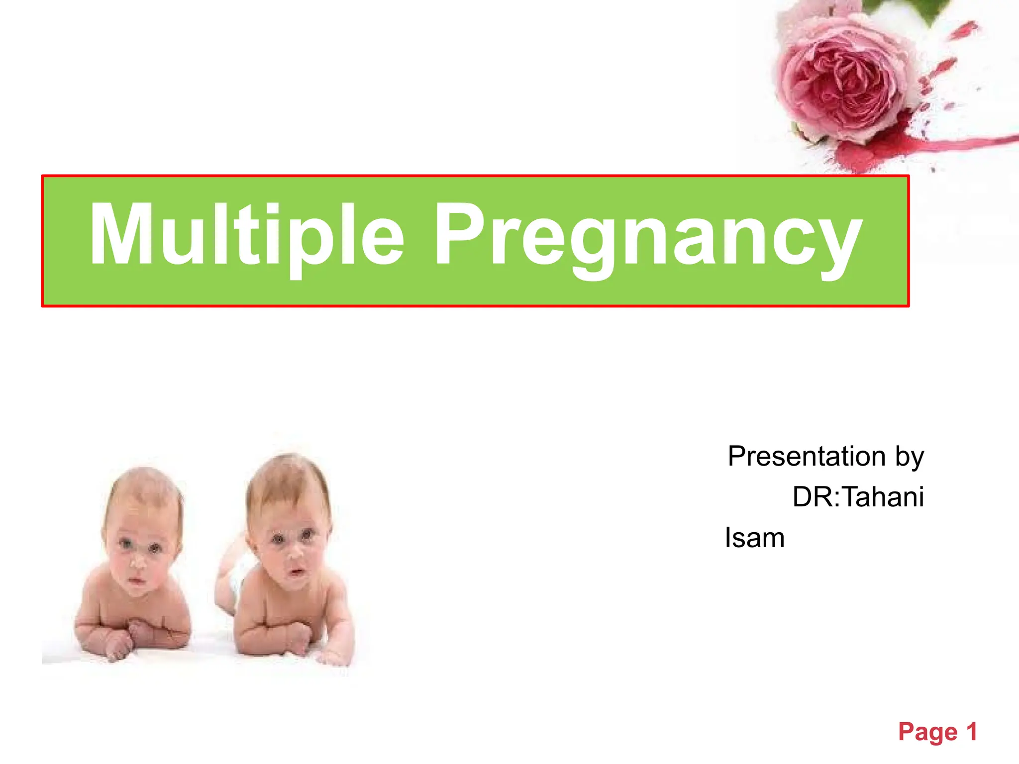 Multiple Pregnancy-managment and diagnosis | PPTX