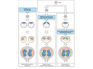 Multiple Pregnancy-managment and diagnosis | PPTX
