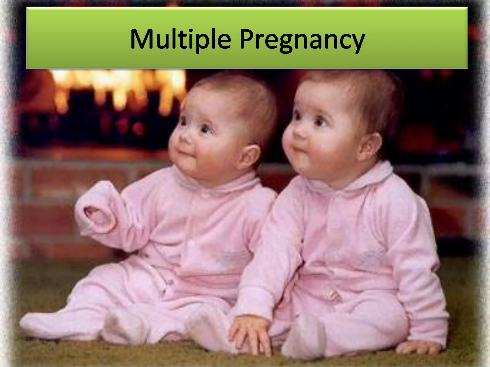 Multiple pregnancy | PPTX