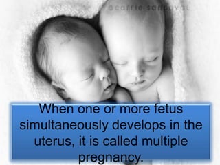 Multiple pregnancy | PPTX