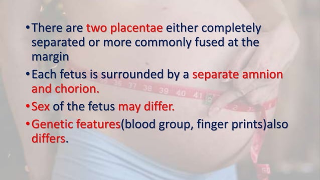 Multiplepregnancy 150512151134-lva1-app6891 | PPT