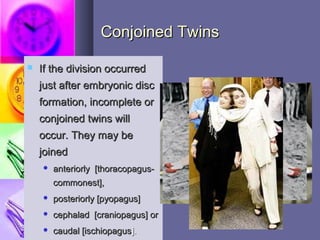 Multiple pregnancy | PPT