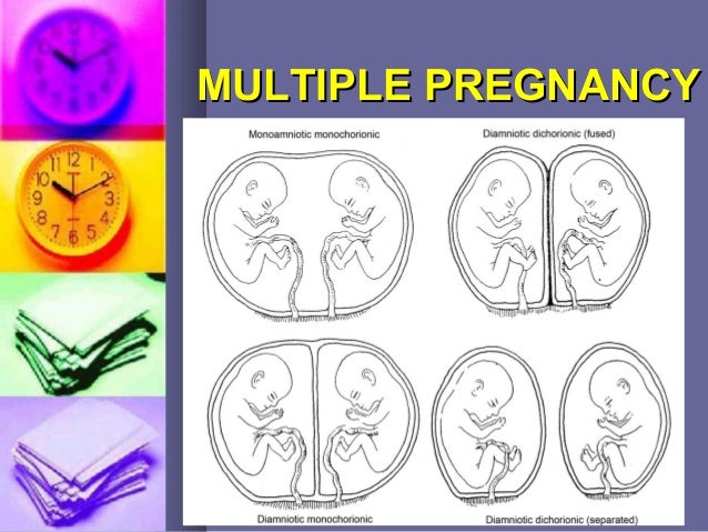 Multiple pregnancy