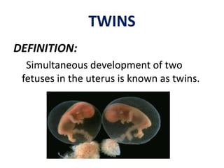 Multiple pregnancy | PPTX