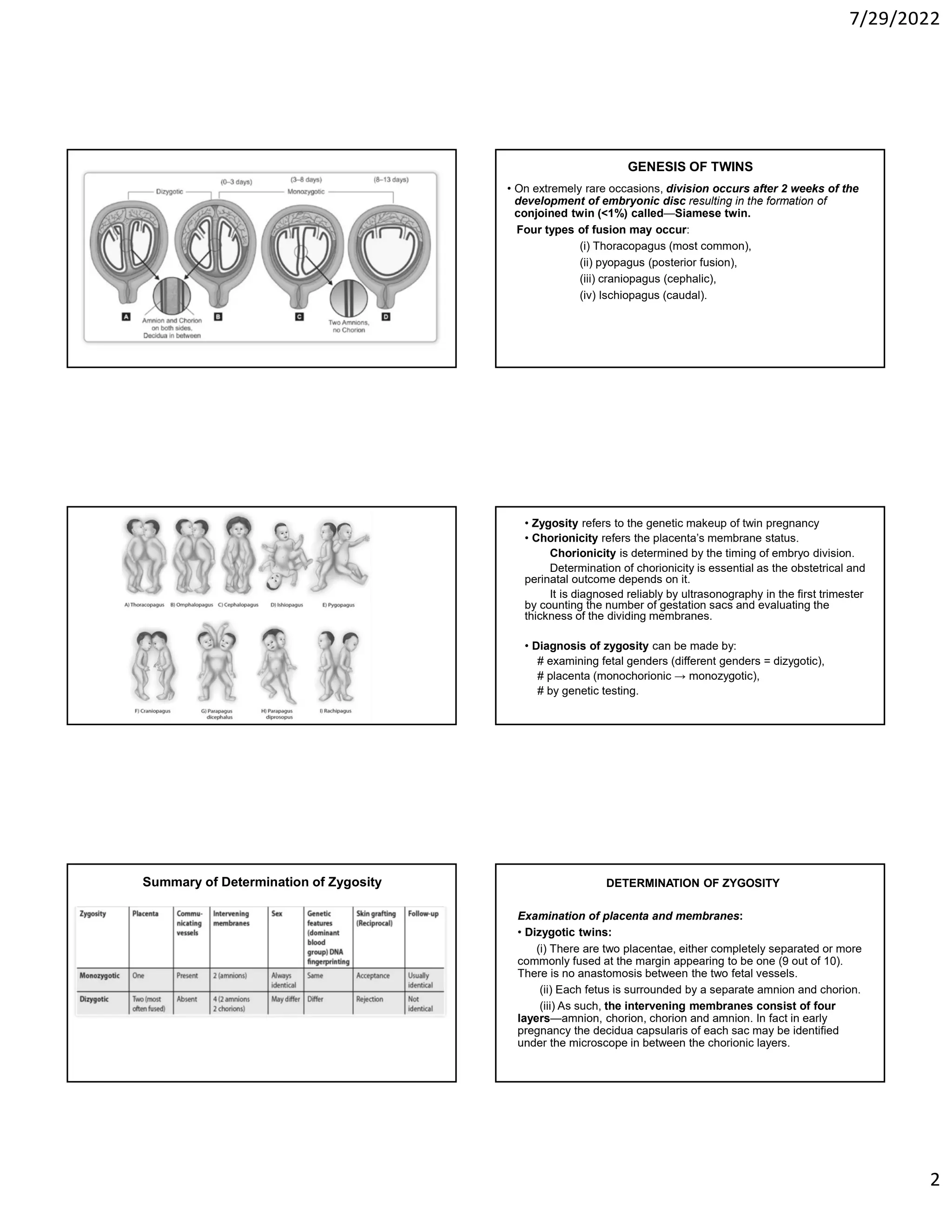 Multiple pregnancy.pdf