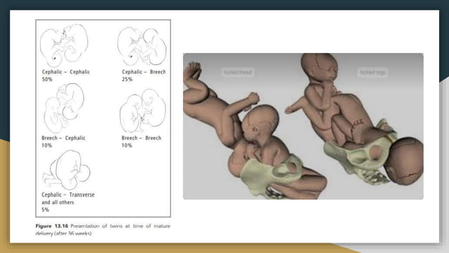 Multiple Pregnancy.pptx
