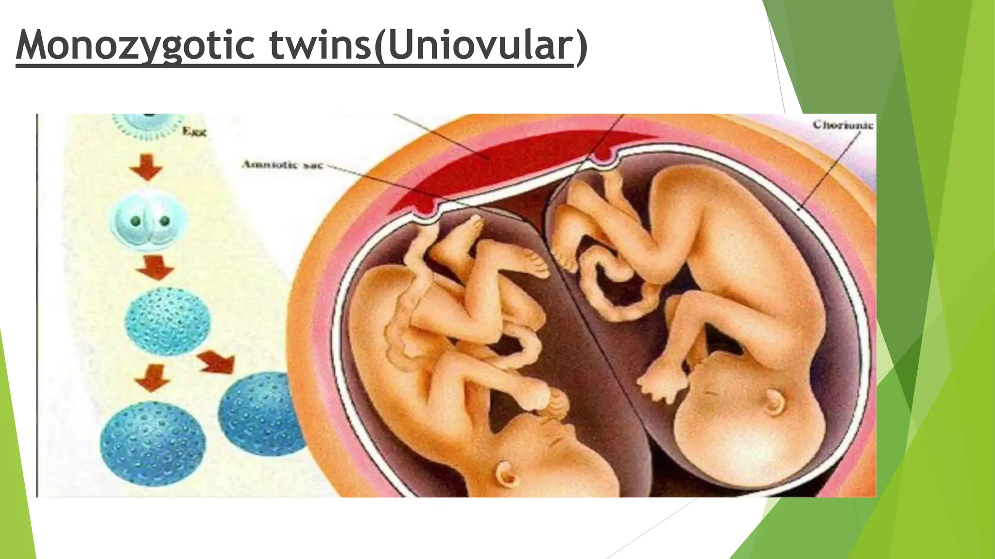 MULTIPLE PREGNANCY, obstetrics and Gynecologist.pptx
