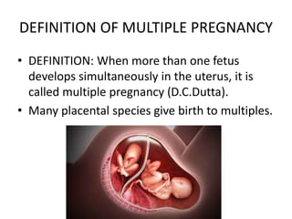 Multiple pregnancy in obstetrics and gynaecology | PPTX