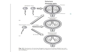 multiple pregnancy(twin) by iraqi doctor.pptx