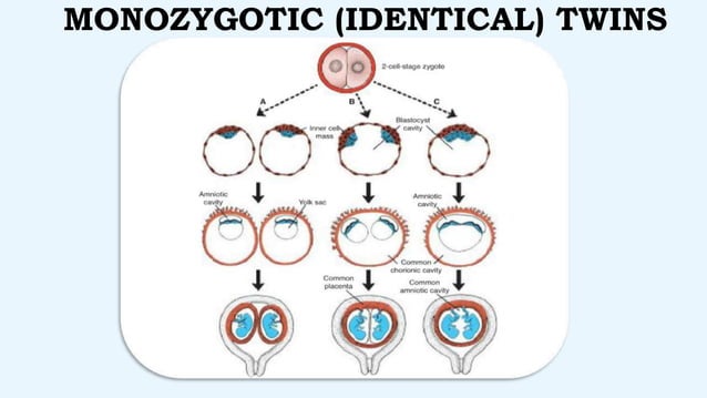MULTIPLE PREGNANCY (CONCEPT OF TWINNING).pptx