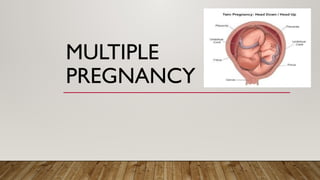 MULTIPLE PREGNANCY twin triplet pregnancy.pptx