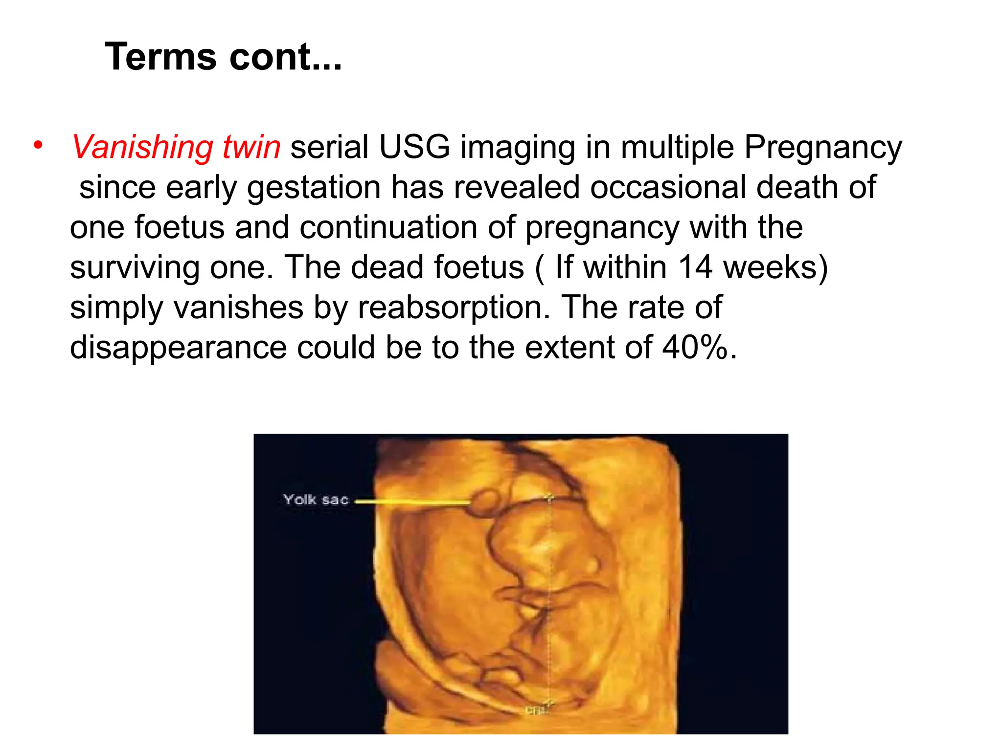 Multiple pregnancy including MCDA and MCMA.pptx