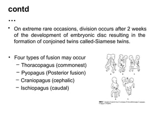 Multiple pregnancy including MCDA and MCMA.pptx