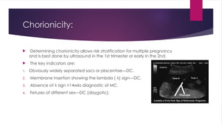 Twin/Multiple pregnancy (Obstetrics).ppt
