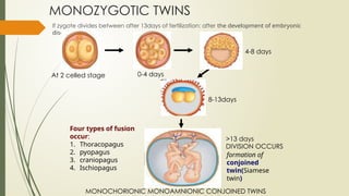 multiple pregnancy ,yamala garbha bams 3rd year | PPTX