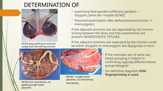 multiple pregnancy ,yamala garbha bams 3rd year | PPTX