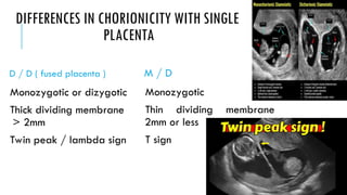 Multiple_Pregnancy_Lecture.ppt TWIN GESTATION | PPT