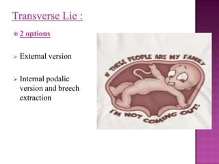 Multiple pregnancy – management | PPTX | Pregnancy | Reproductive Health