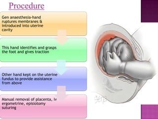 Multiple pregnancy – management | PPTX