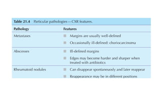 MULTIPLE PULMONARY NODULE xray findings.pptx